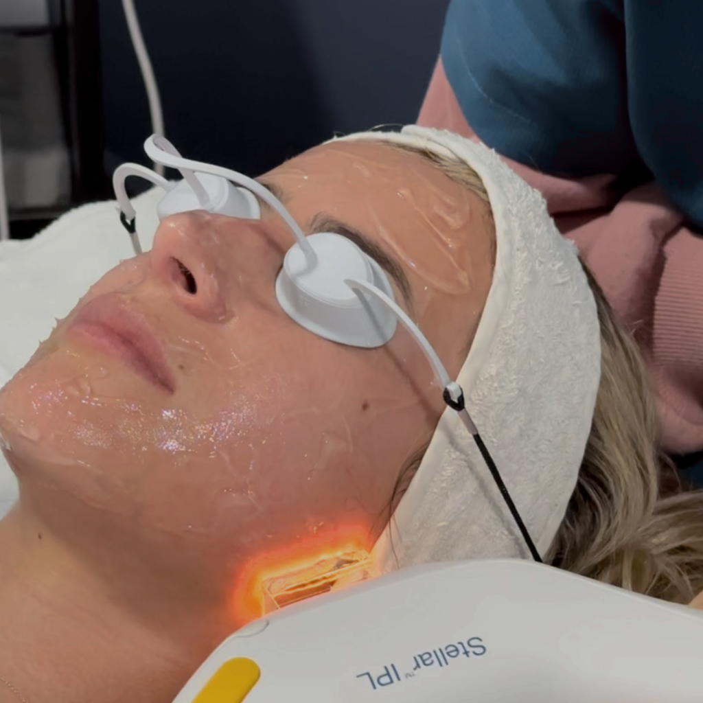 STELLAR M22 ACNÉ - LeDerme