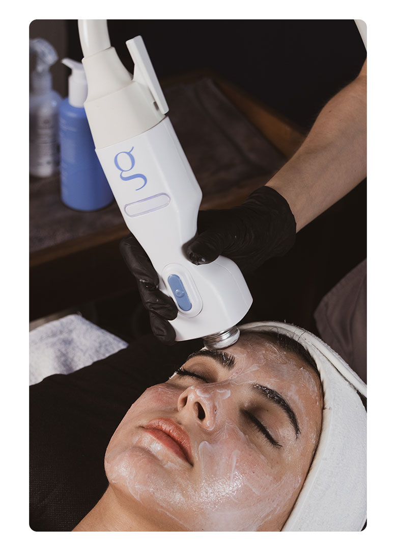 GLACIAL FX EN GUADALAJARA - LeDerme